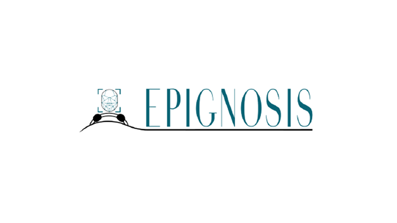 BrightLoop joins forces with AVL Italia on the EPIGNOSIS project! - BrightLoop